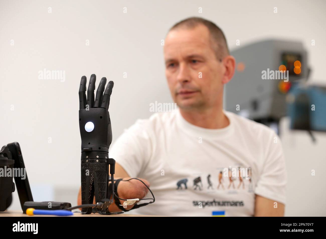 LVIV, UKRAINE - APRIL 14, 2023 - One of the first patients is set to be ...