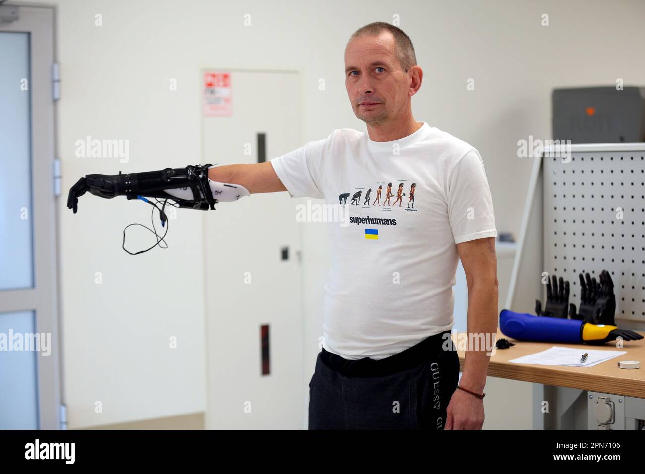 LVIV, UKRAINE - APRIL 14, 2023 - One of the first patients gets ...