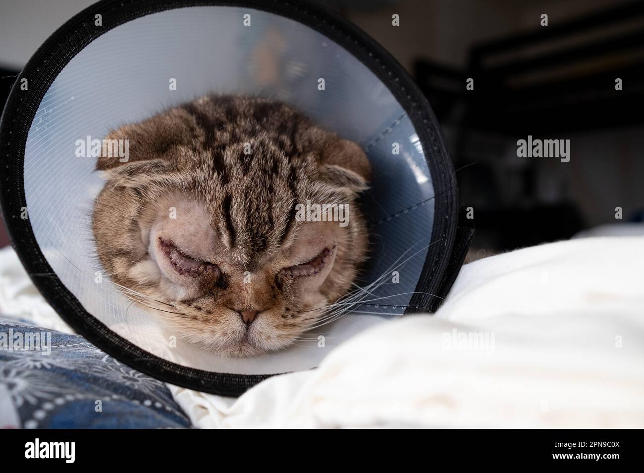 Bilateral entropion hi-res stock photography and images - Alamy