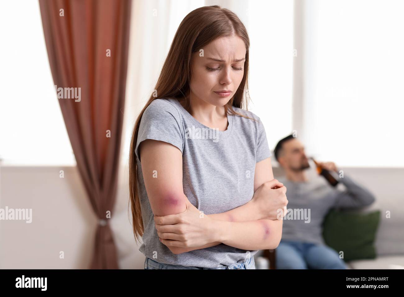 Bruised young woman at home. Domestic violence concept Stock Photo - Alamy