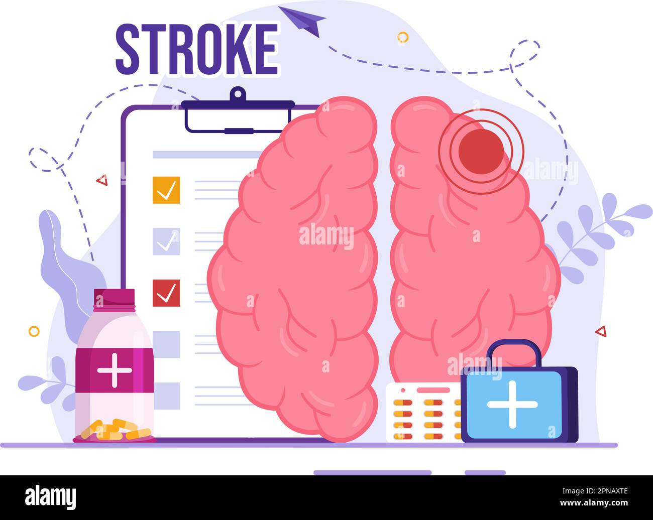 Human Brain Stroke Vector Illustration with Scientific Medical ...
