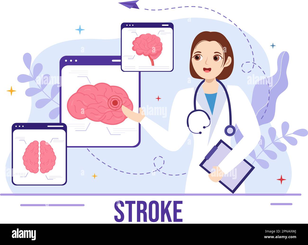 Brain hemorrhage anatomy Stock Vector Images - Alamy
