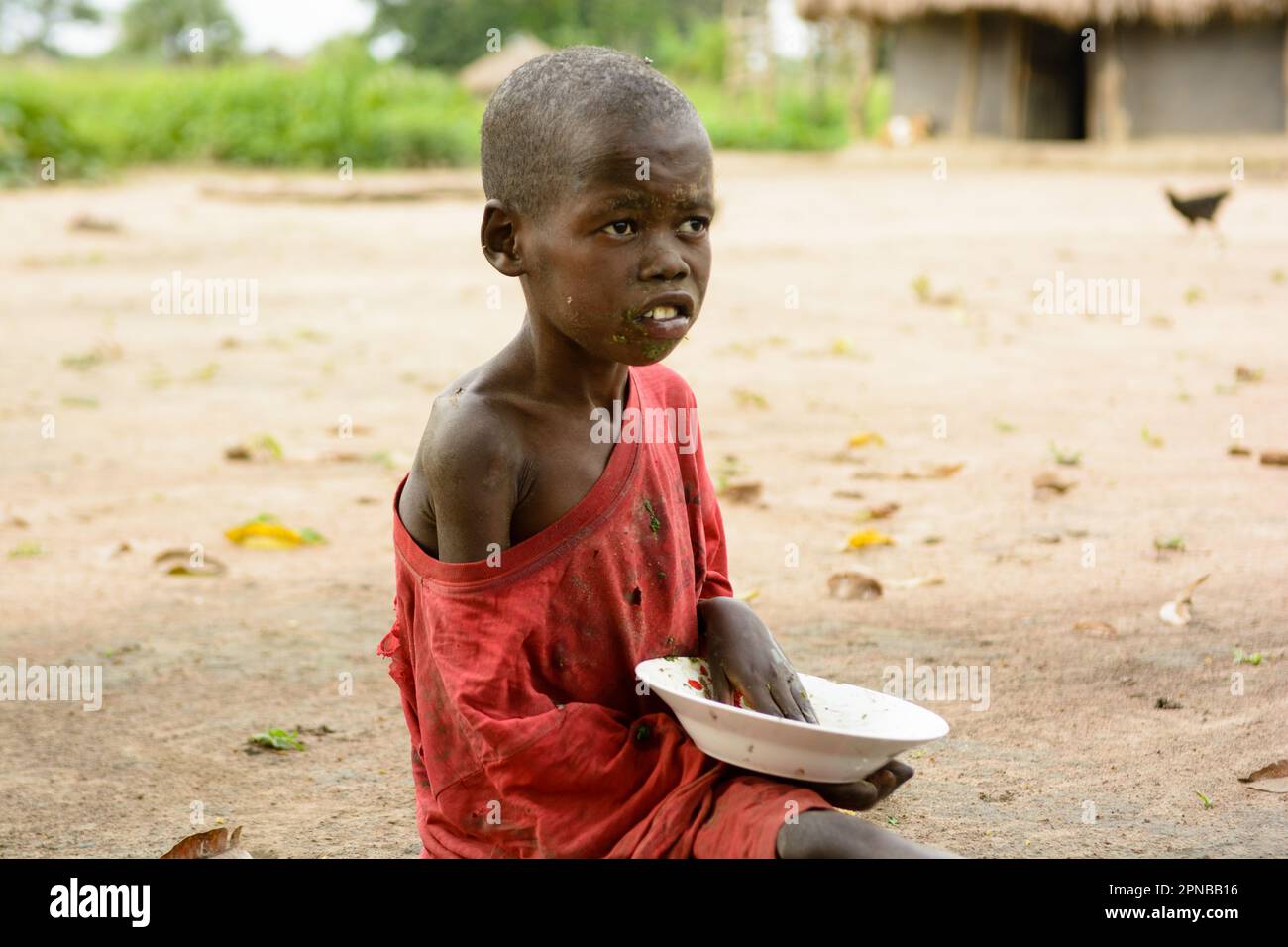 Anorexic Kids In Africa