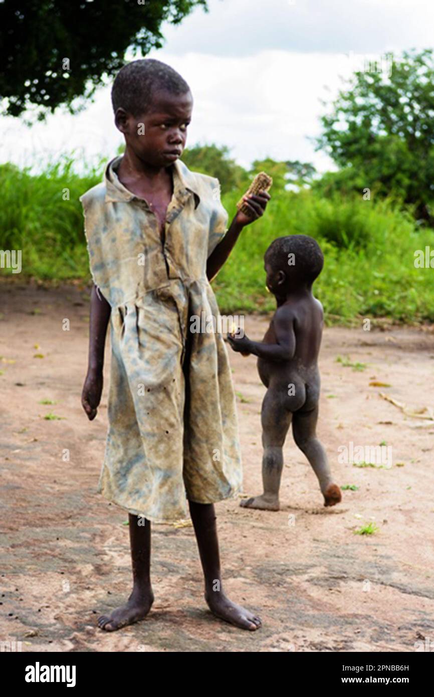 Nodding syndrome hi-res stock photography and images - Alamy