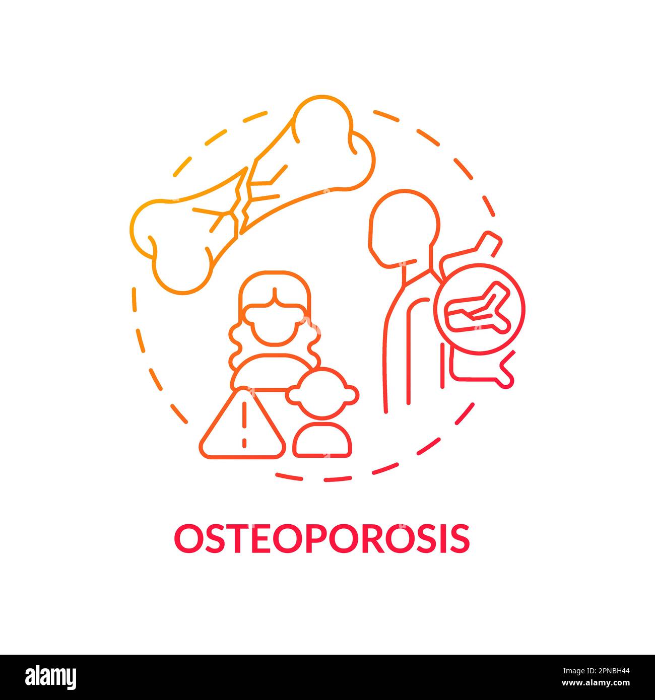 Osteoporosis red gradient concept icon Stock Vector Image & Art - Alamy