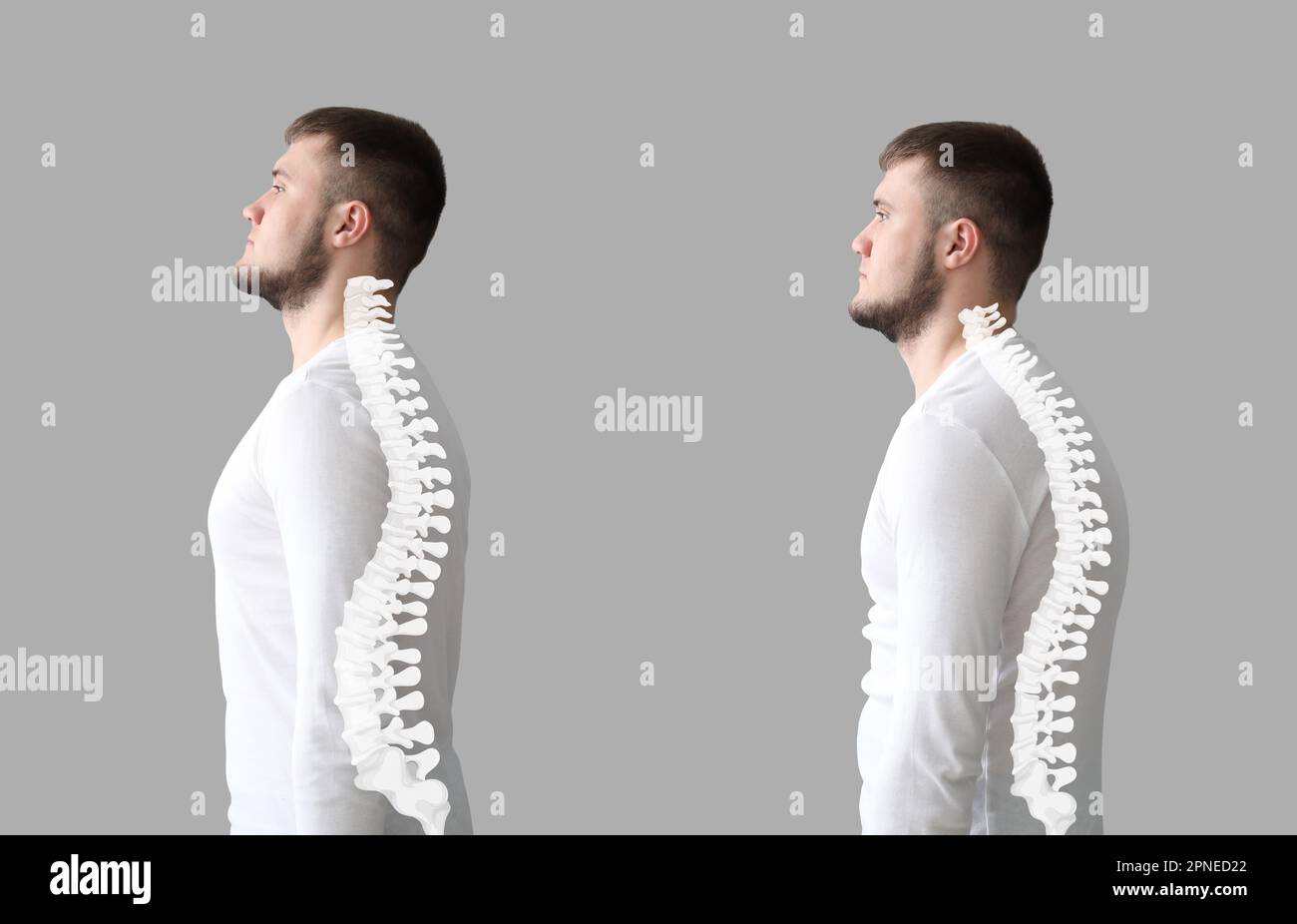 Hunch posture hi-res stock photography and images - Alamy