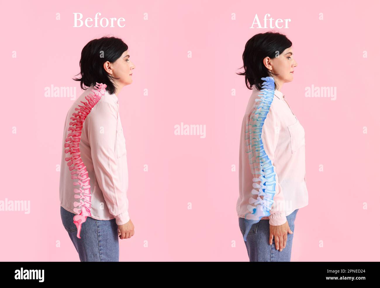 Woman with bad and proper posture on pink background Stock Photo - Alamy