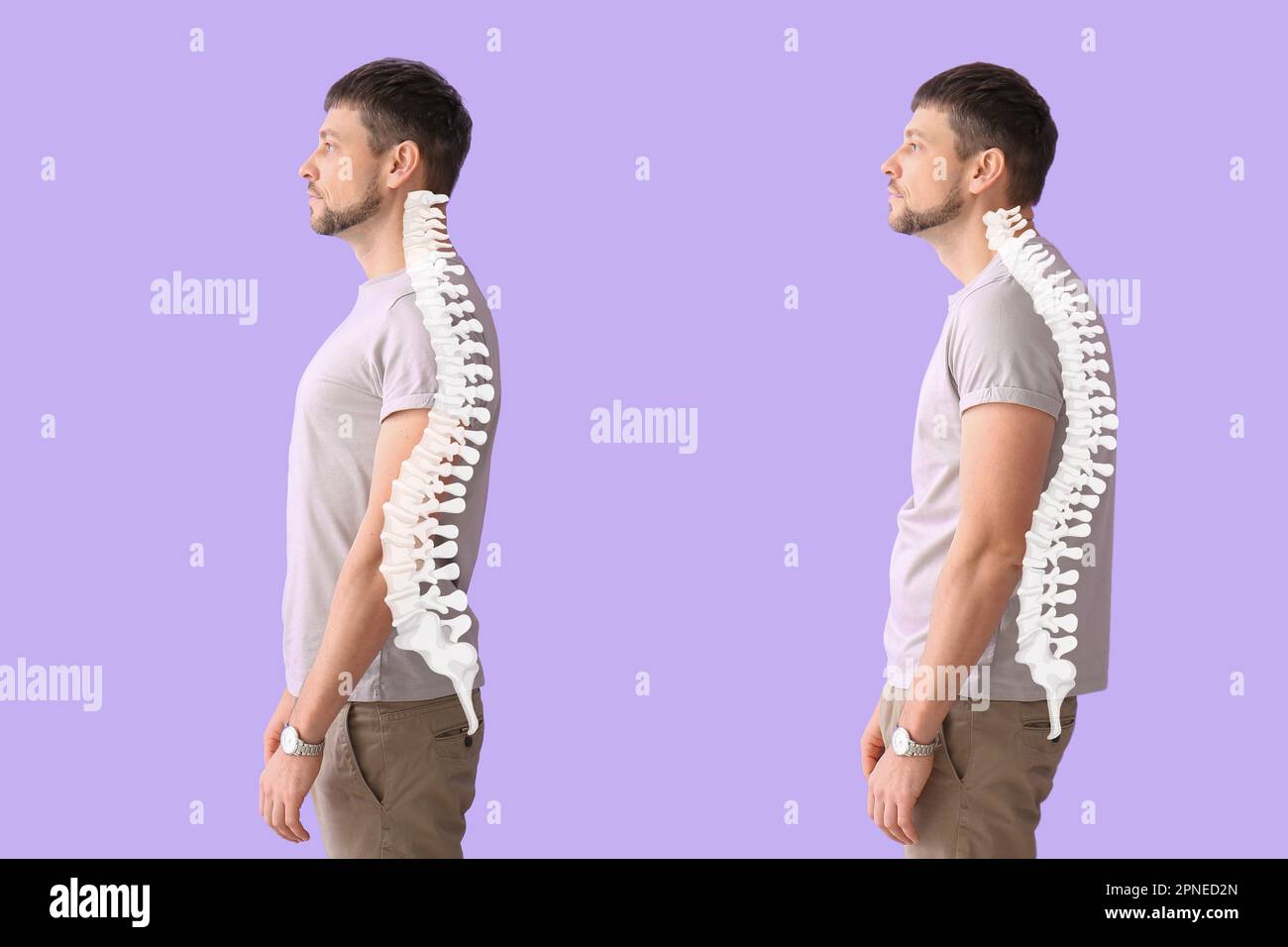 Man with bad and proper posture on lilac background Stock Photo - Alamy
