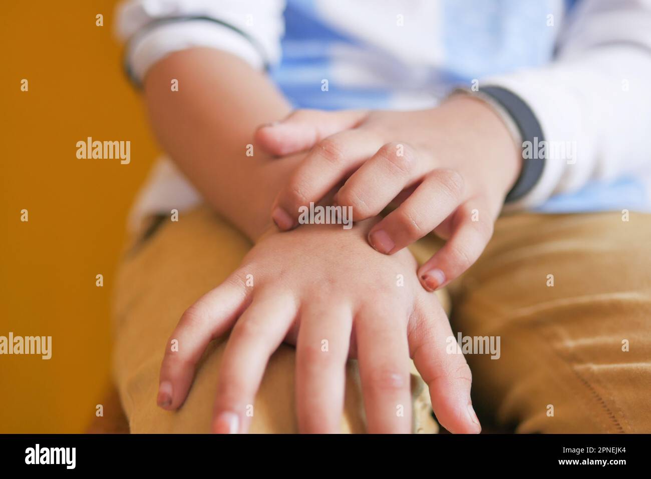 child girl suffering from itching skin on hand Stock Photo - Alamy