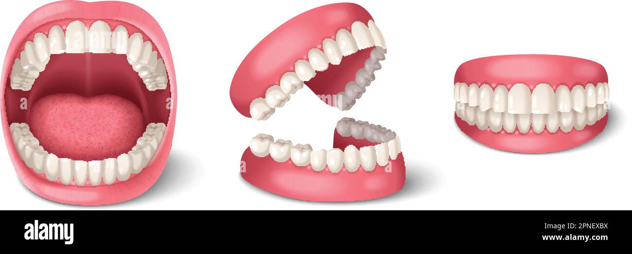 Realistic tooth and dental implant for stomatology or dentistry ...