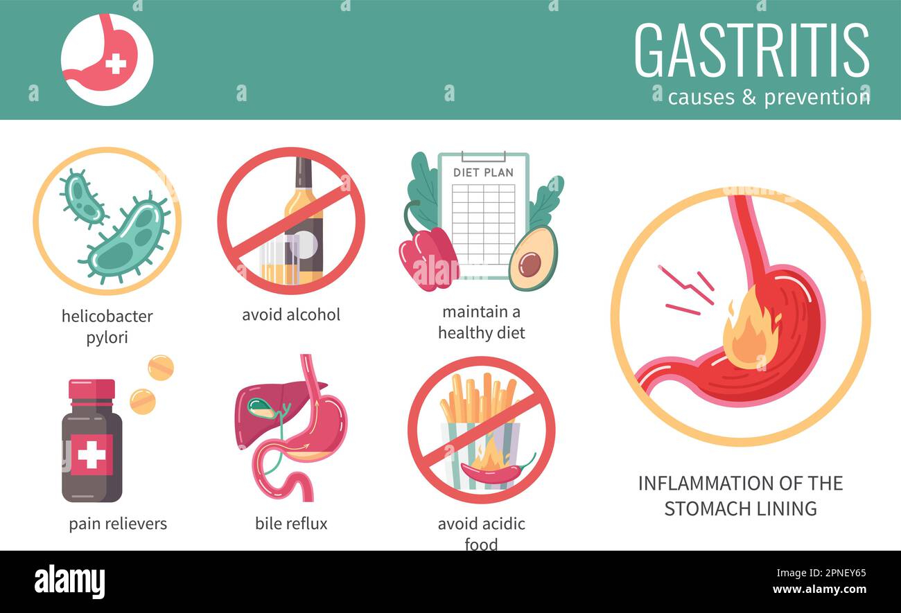 GERD flat infographics with gastritis causes and prevention symbols ...
