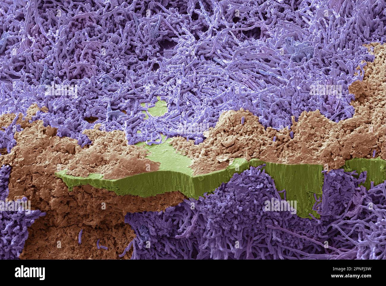 Tooth bacteria, SEM Stock Photo - Alamy