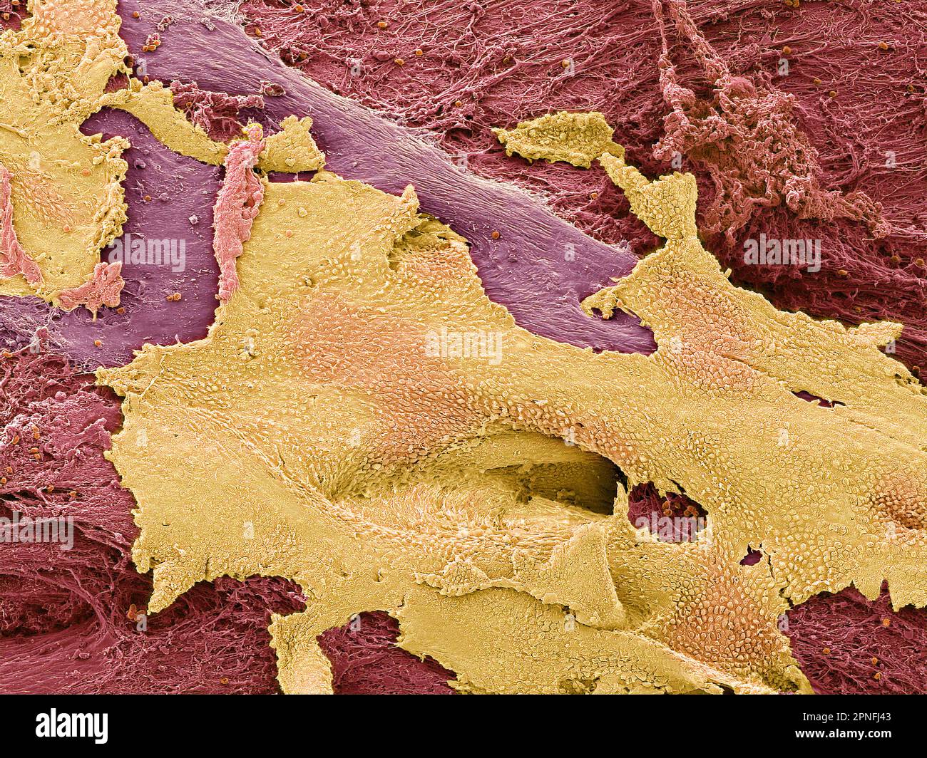 Uterus during menstruation, SEM Stock Photo - Alamy