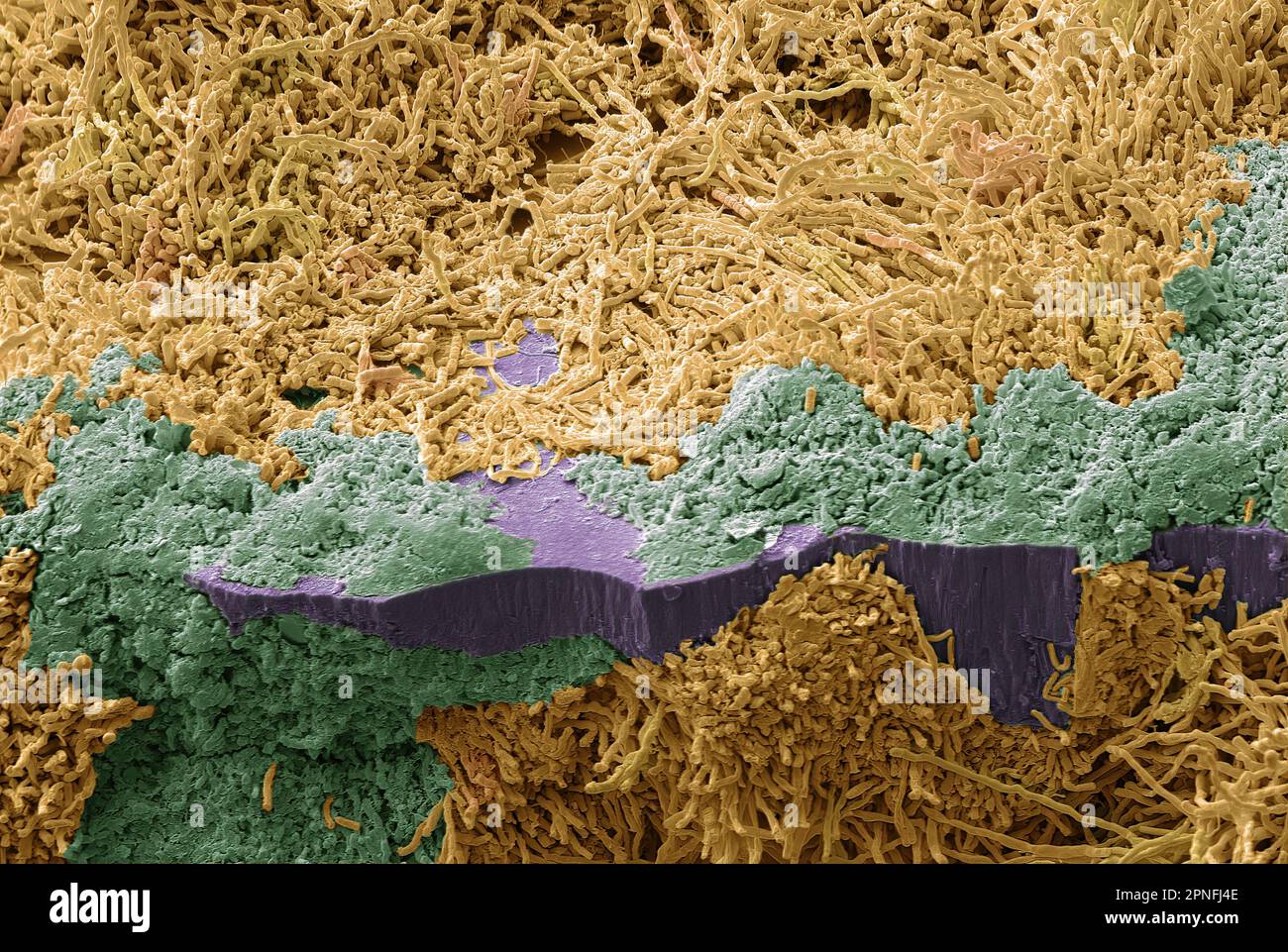 Tooth bacteria, SEM Stock Photo - Alamy
