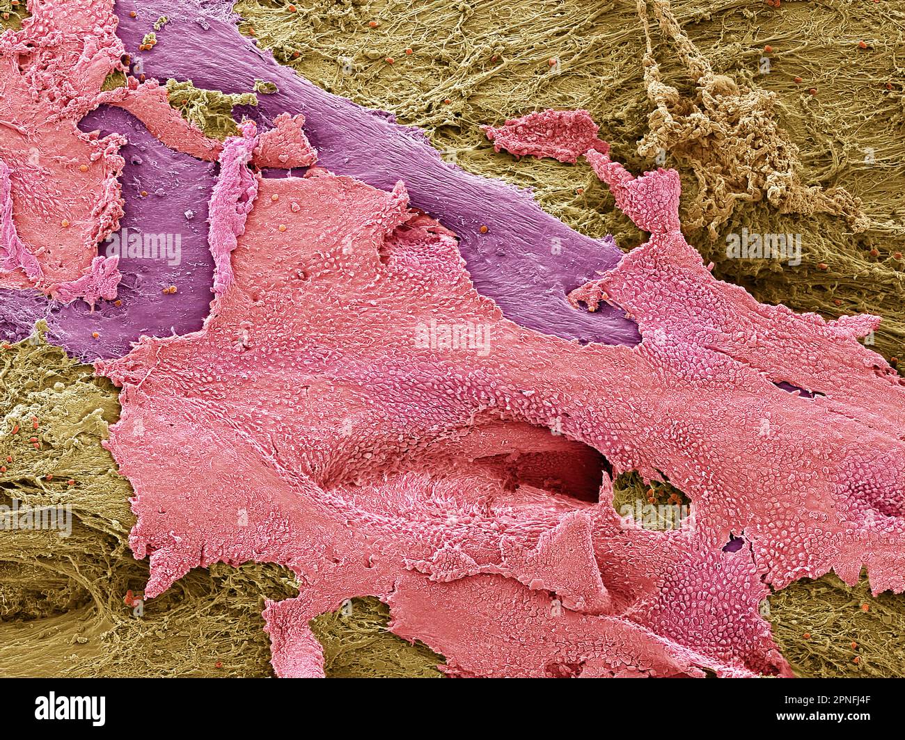 Uterus during menstruation, SEM Stock Photo - Alamy