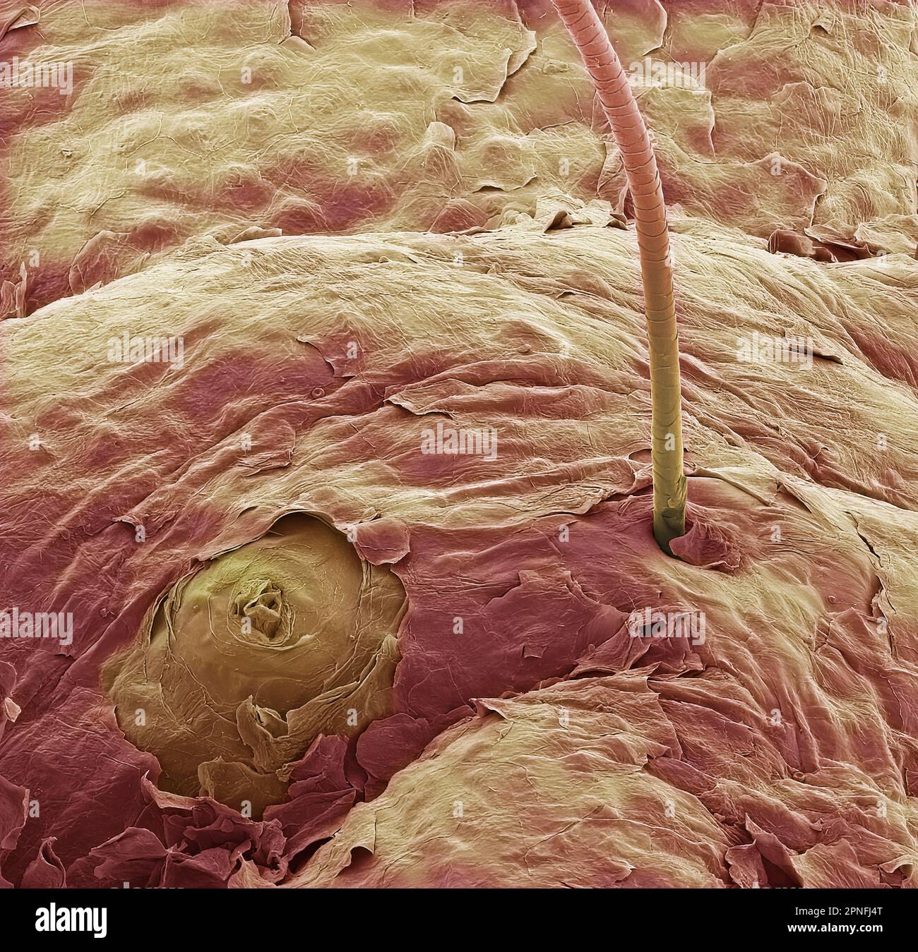 Human skin, SEM Stock Photo - Alamy