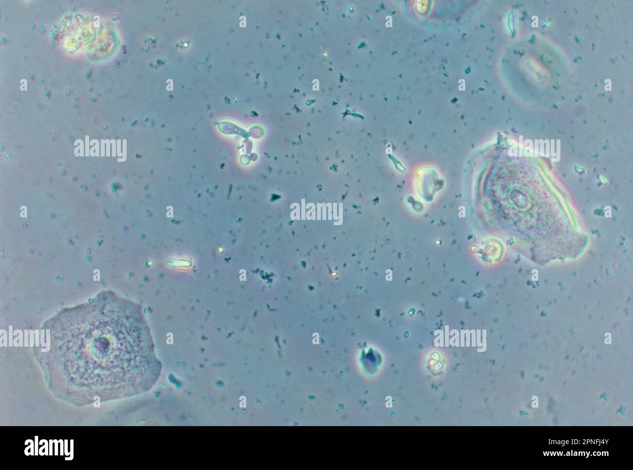 Candida albicans, light micrograph Stock Photo - Alamy