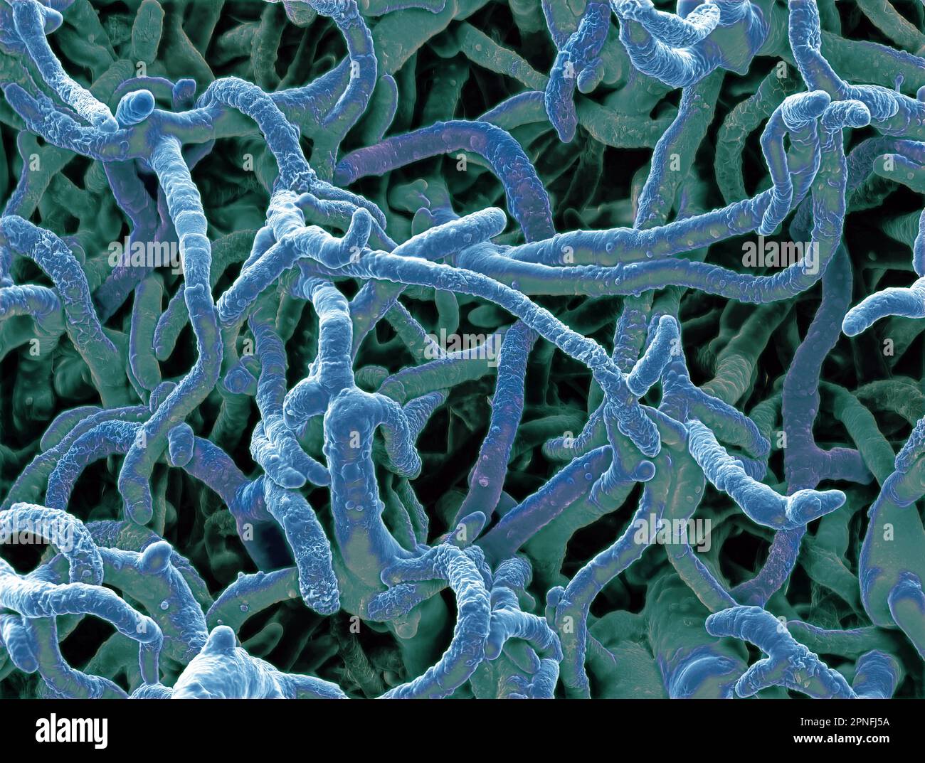 Fungal hyphae, SEM Stock Photo - Alamy