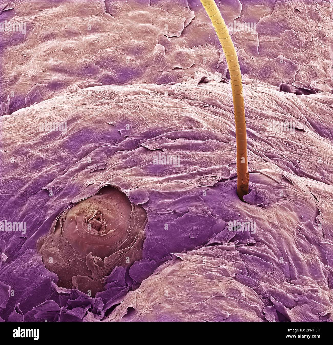Human skin, SEM Stock Photo - Alamy