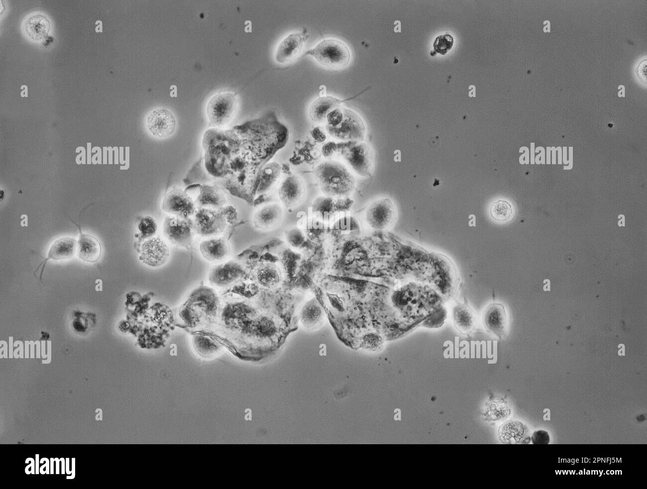 Trichomoniasis, light micrograph Stock Photo - Alamy