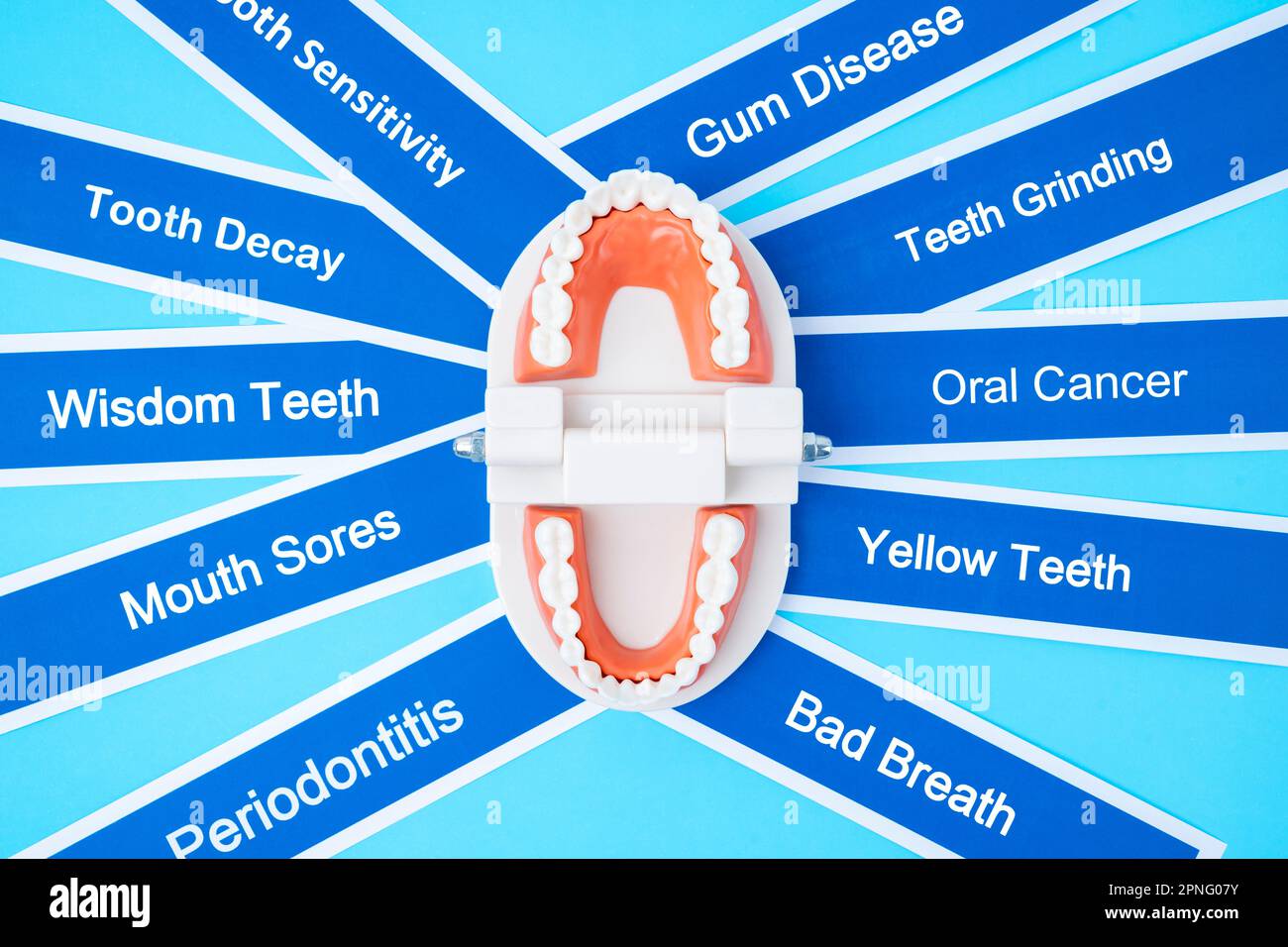 Dentures model with dental disease on blue background Stock Photo - Alamy