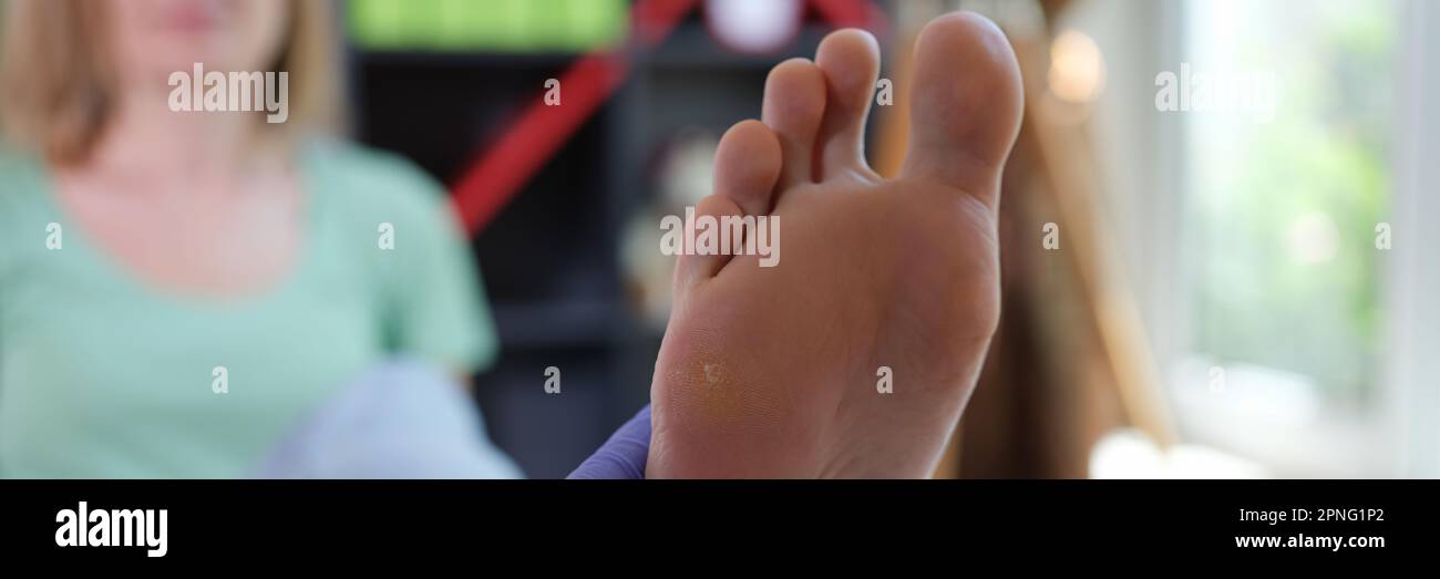 Doctor podiatrist in sterile gloves examining female foot Stock Photo ...