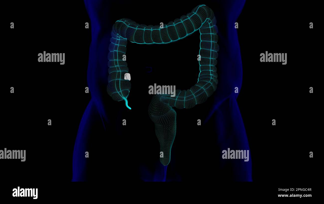 3D Illustration Human Digestive System Anatomy (Large Intestine) For ...