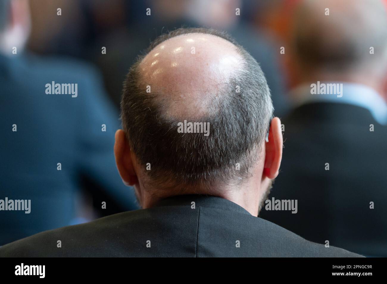 Half bald half hair hi-res stock photography and images - Alamy