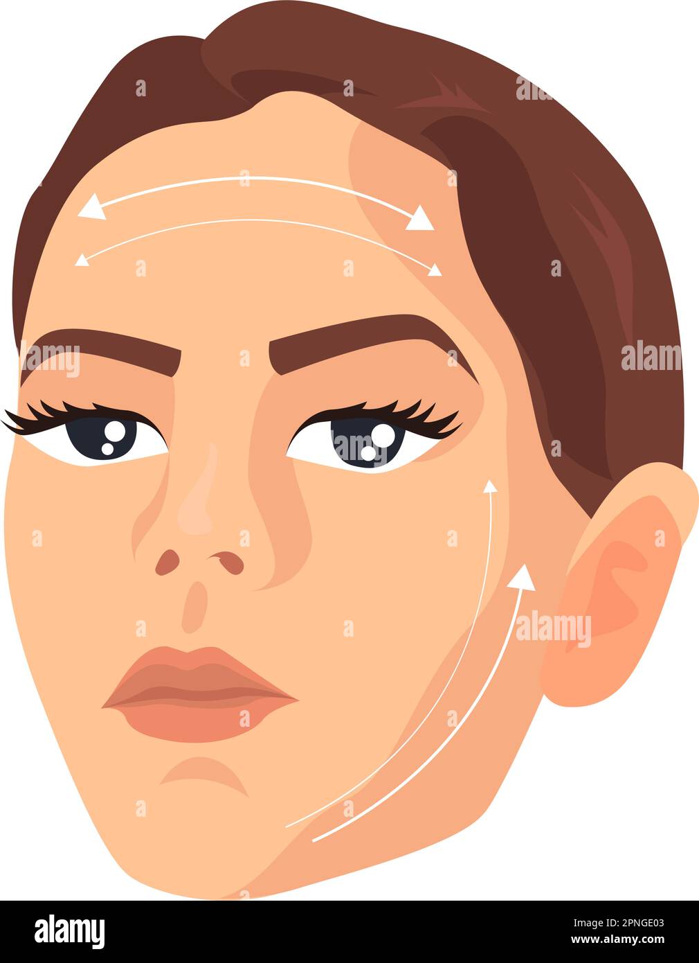 Facelift illustration in color cartoon style. Editable vector graphic ...