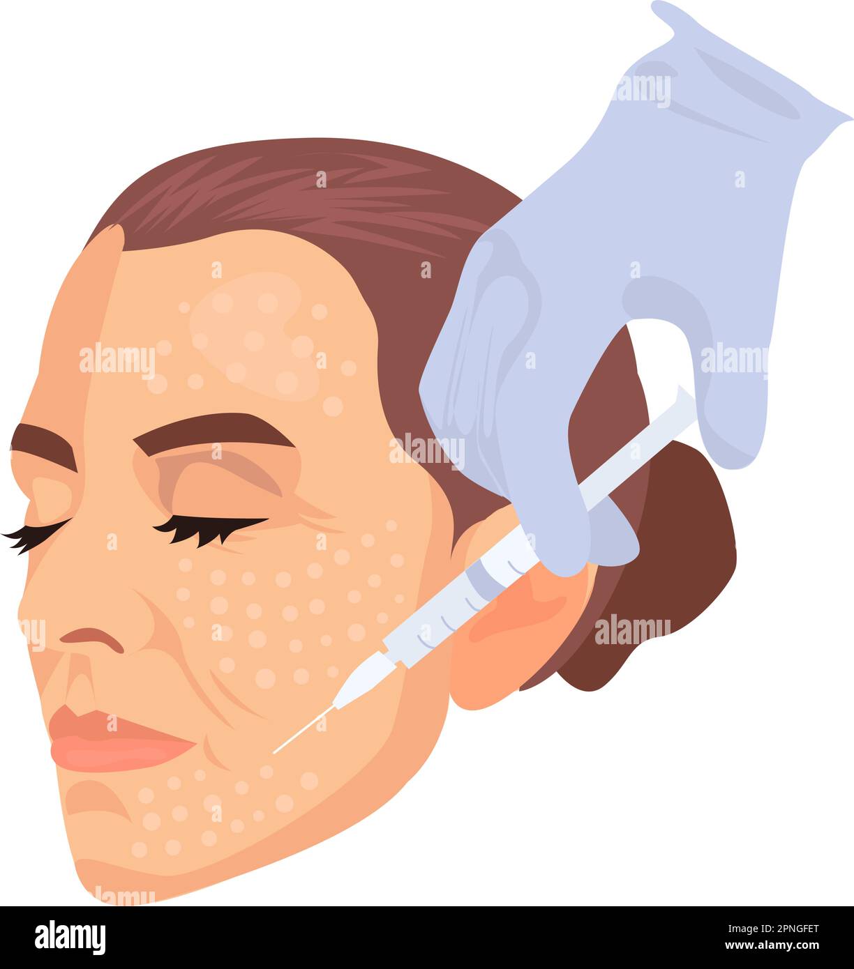 Facial rejuvenation illustration in color cartoon style. Editable ...