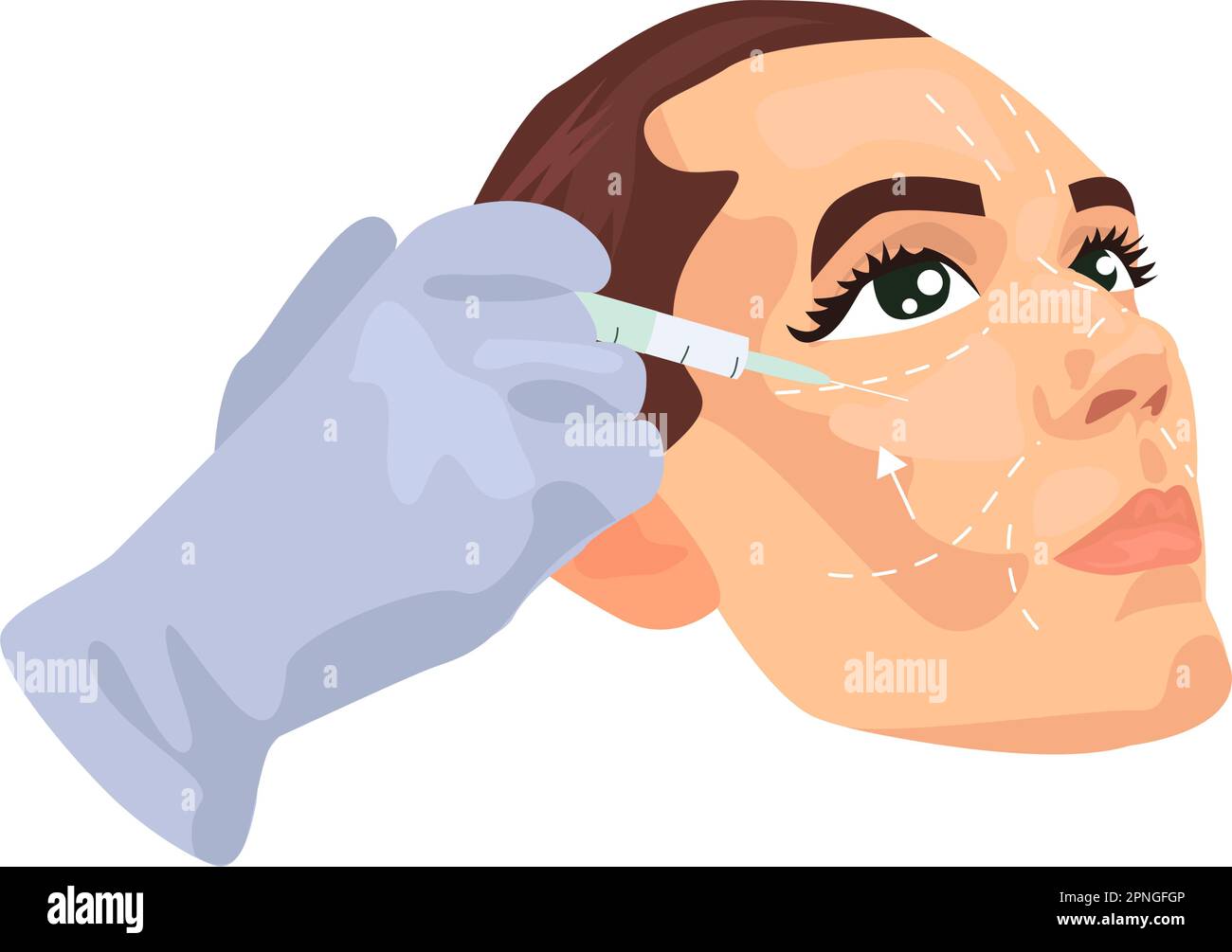 Beauty injections illustration in color cartoon style. Editable vector ...