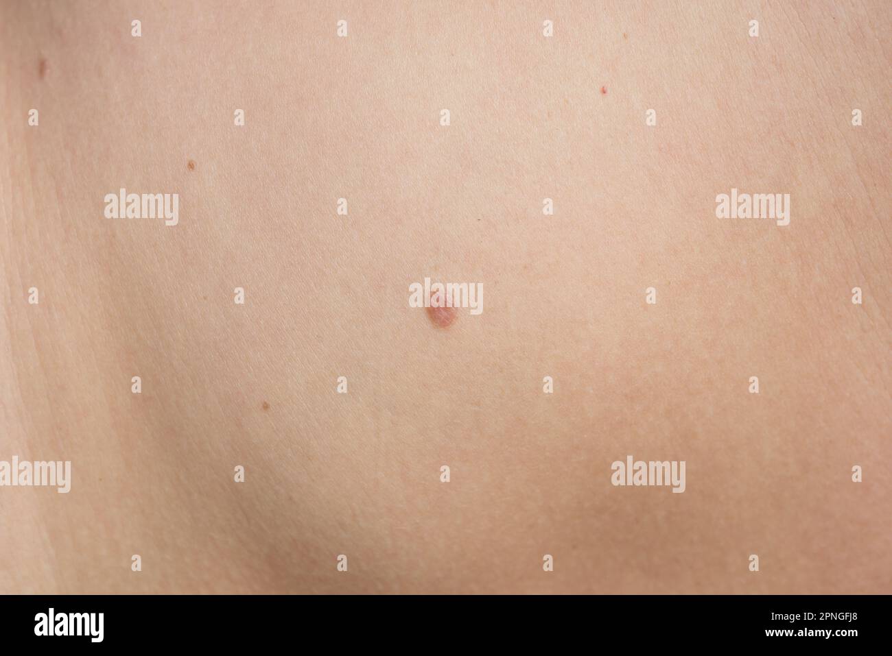 Full frame of human skin Stock Photo - Alamy