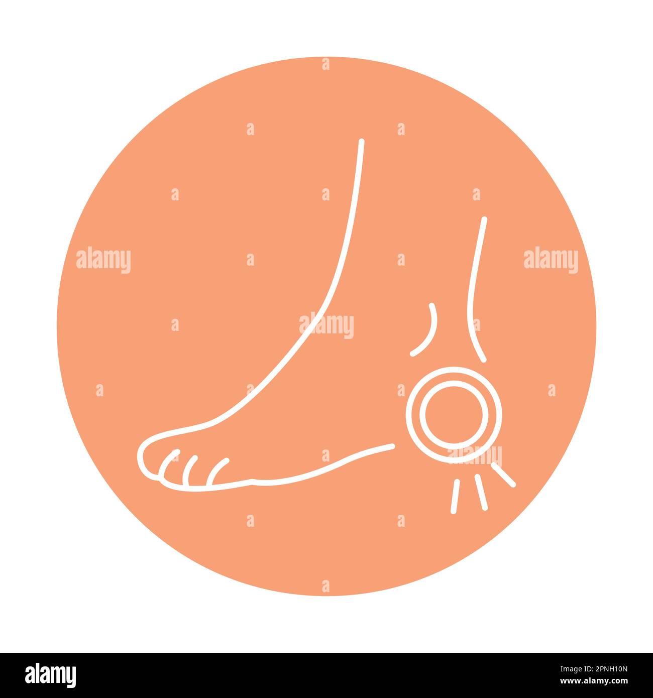 Heel spur treatment vector vectors hi-res stock photography and images ...