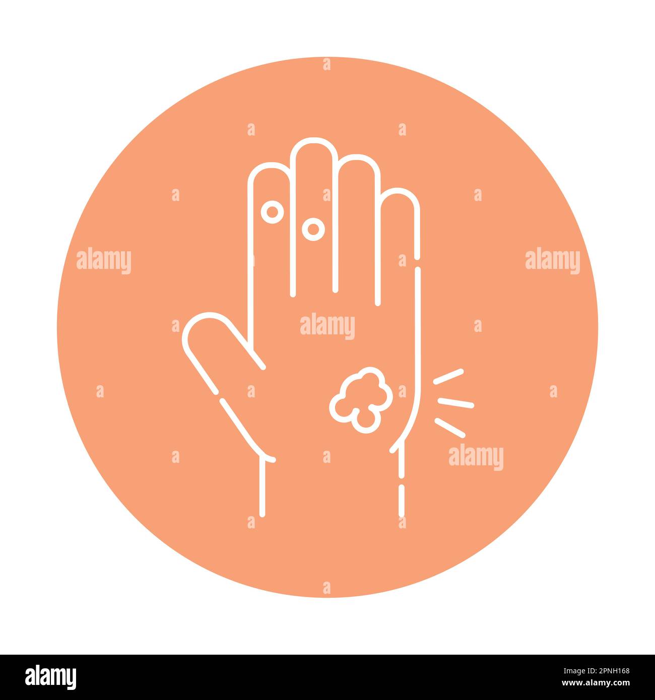 Warts hand Stock Vector Images - Alamy