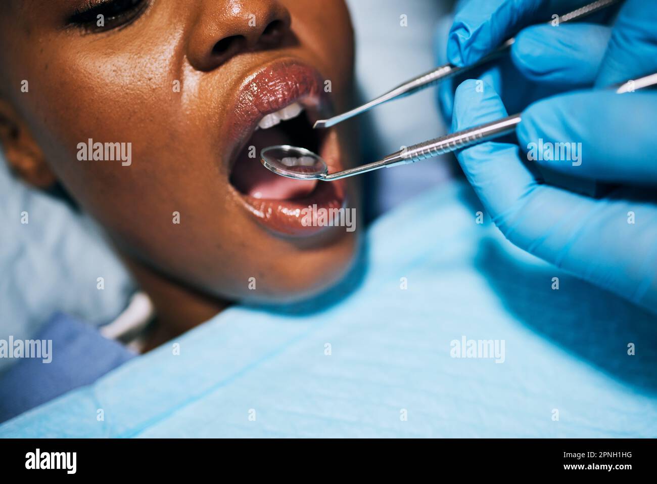 Mouth, woman and hands of dentist in dental surgery for clean teeth ...