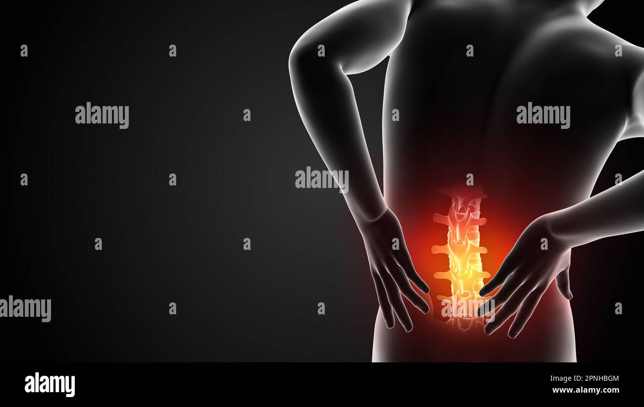 Human holding back due to back pain Stock Photo - Alamy