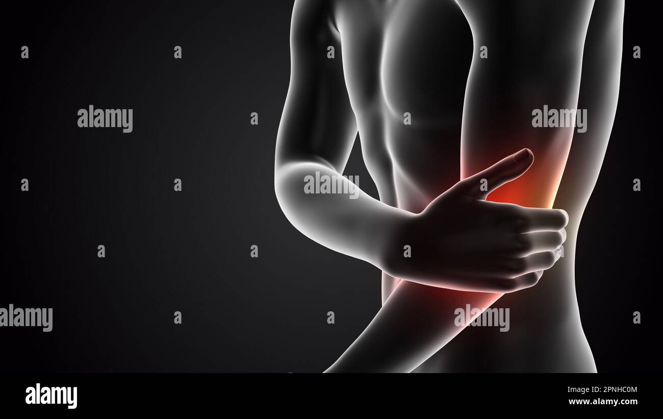 Human having pain in Arm Stock Photo - Alamy