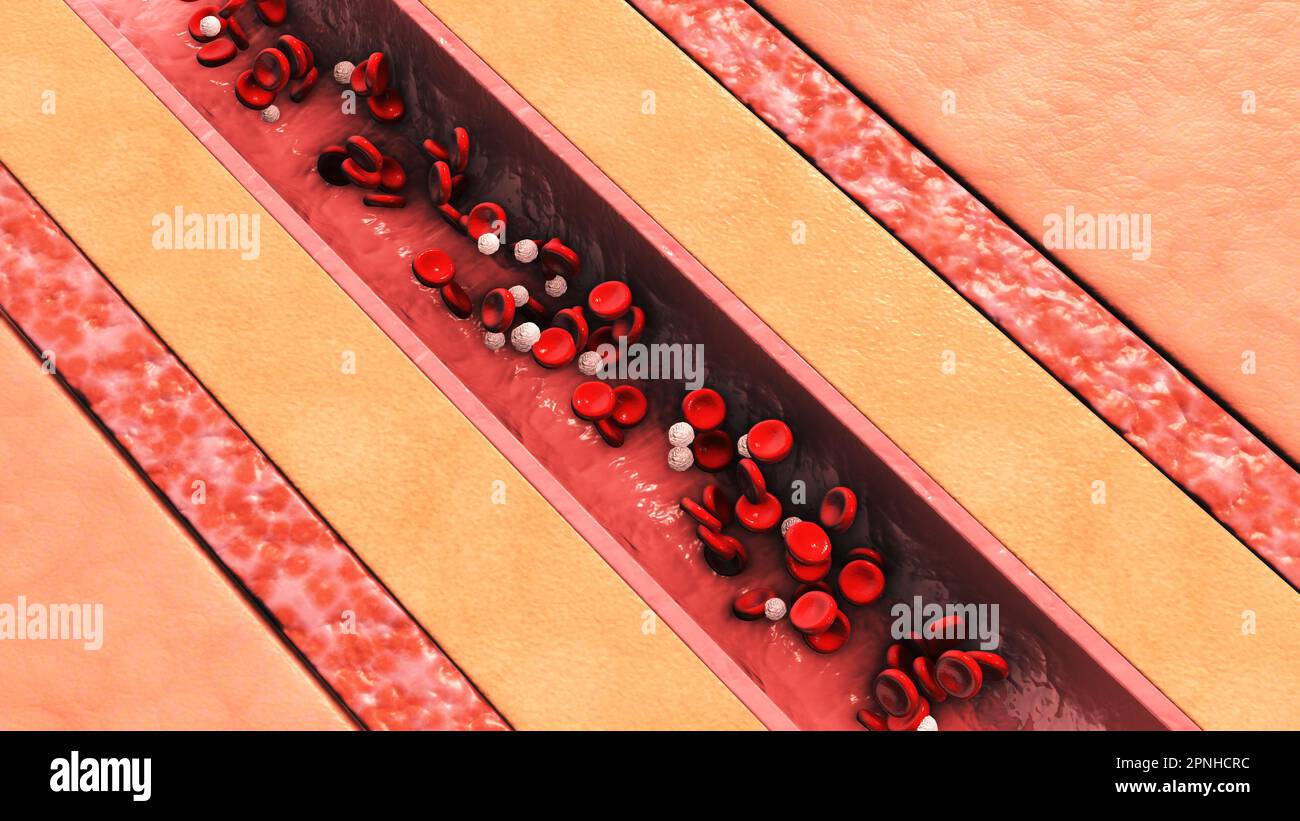 Human blood vessel in section with red and white blood cells Stock ...