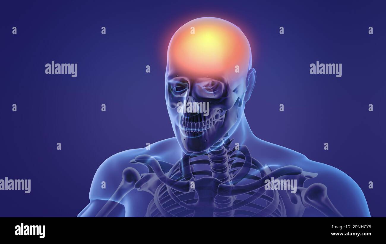 Concept of a human having headache Stock Photo - Alamy