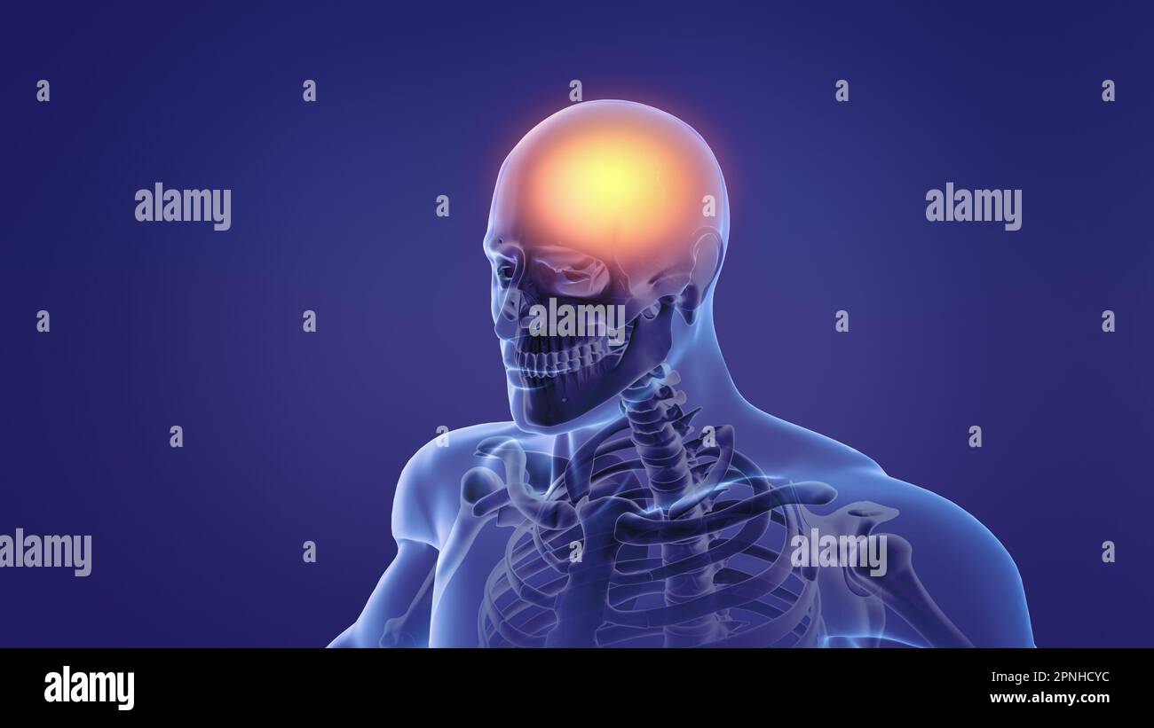 Concept of a human having headache Stock Photo - Alamy