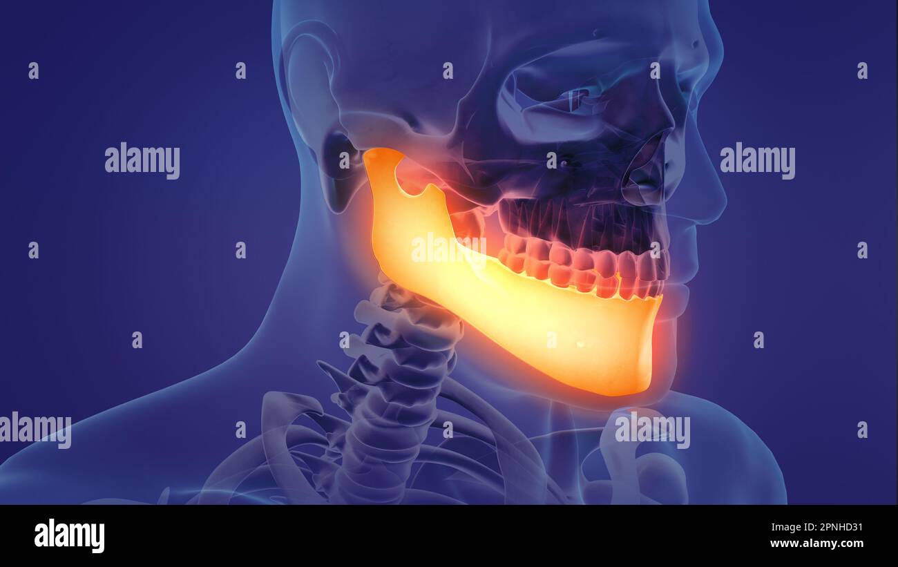 Animation of a painful mandible Stock Photo - Alamy