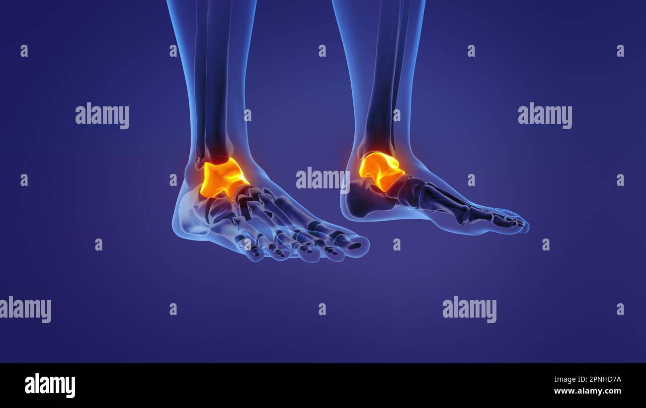 Anatomy Of Talus Understanding The Recovery Journey Of Talus Bone