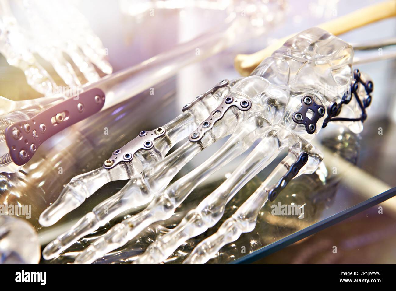 Titanium alloy surgical hi-res stock photography and images - Alamy