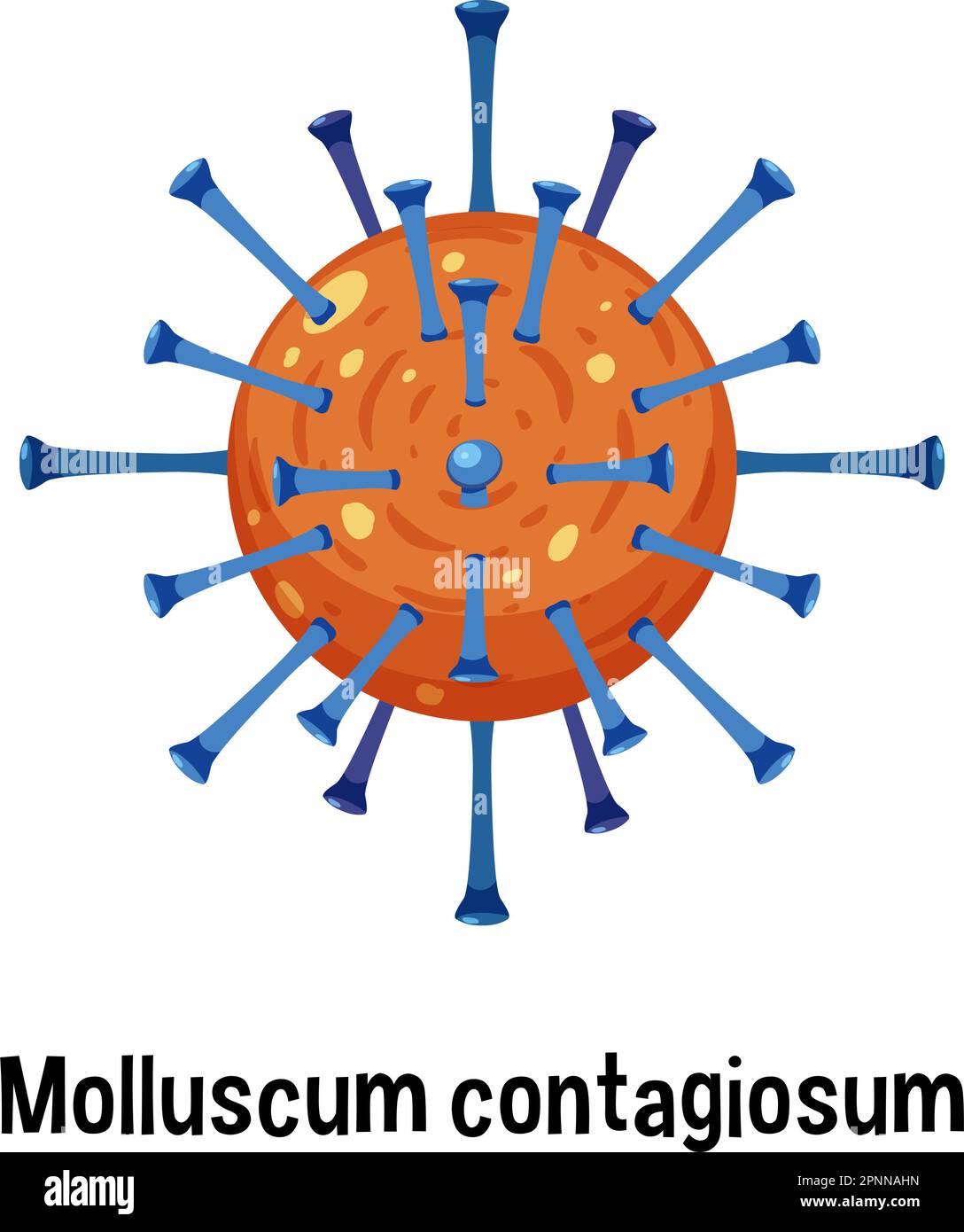 Molluscum contagiosum with text illustration Stock Vector Image & Art ...