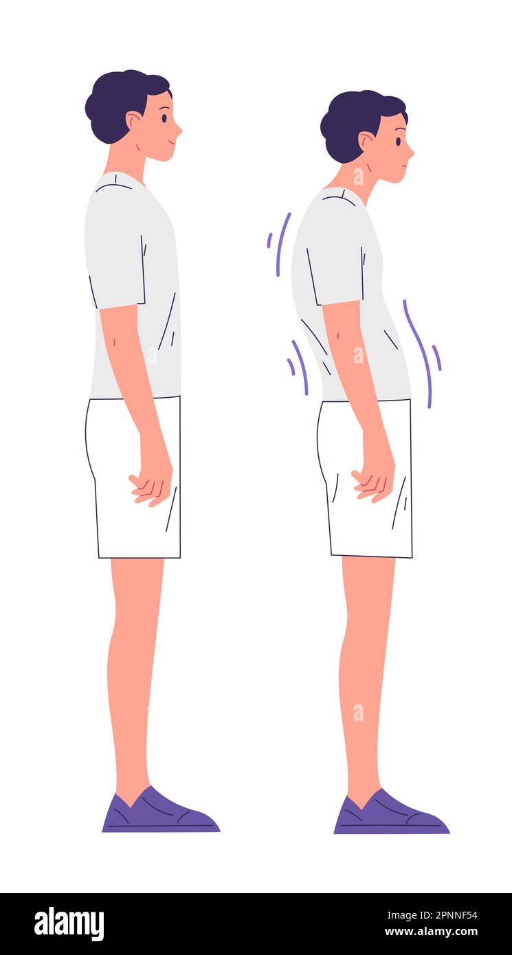 Lordotic Stock Vector Images - Alamy