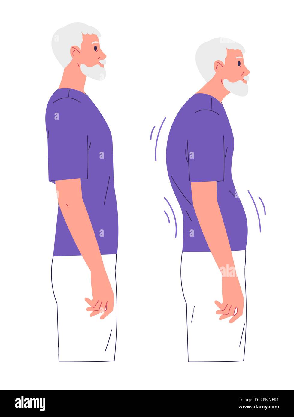 Elderly man with impaired posture and correct posture Stock Vector ...
