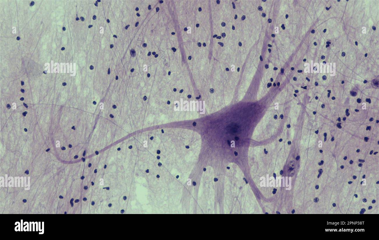 Nervous Tissue Slide Neuron Multipolar Neuron (basic Cell Of Nervous