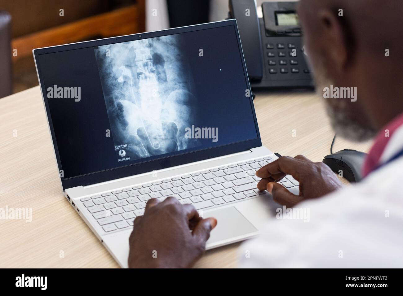 African american male doctor using laptop with radiograph on screen at ...