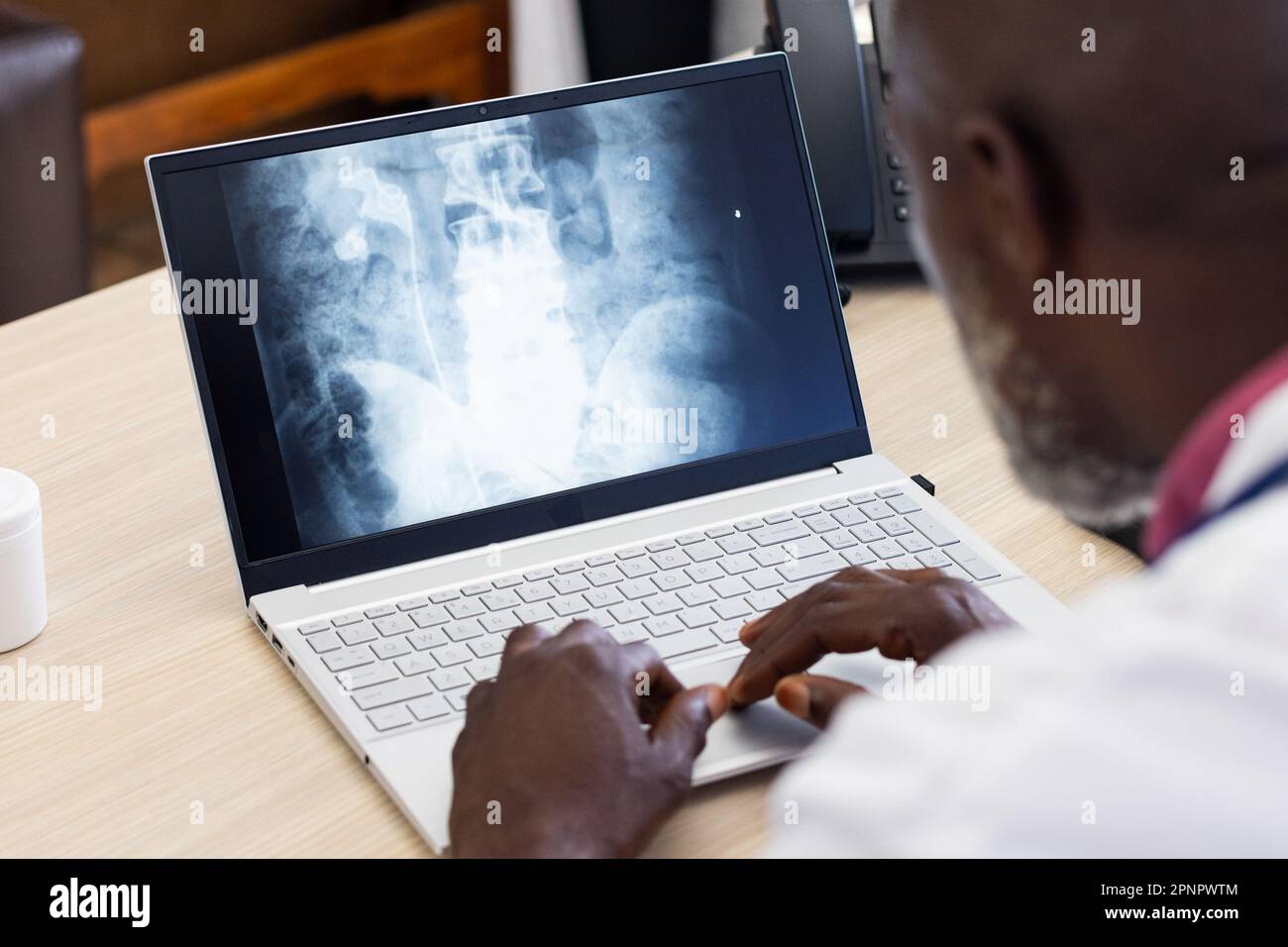 African american male doctor using laptop with radiograph on screen at ...