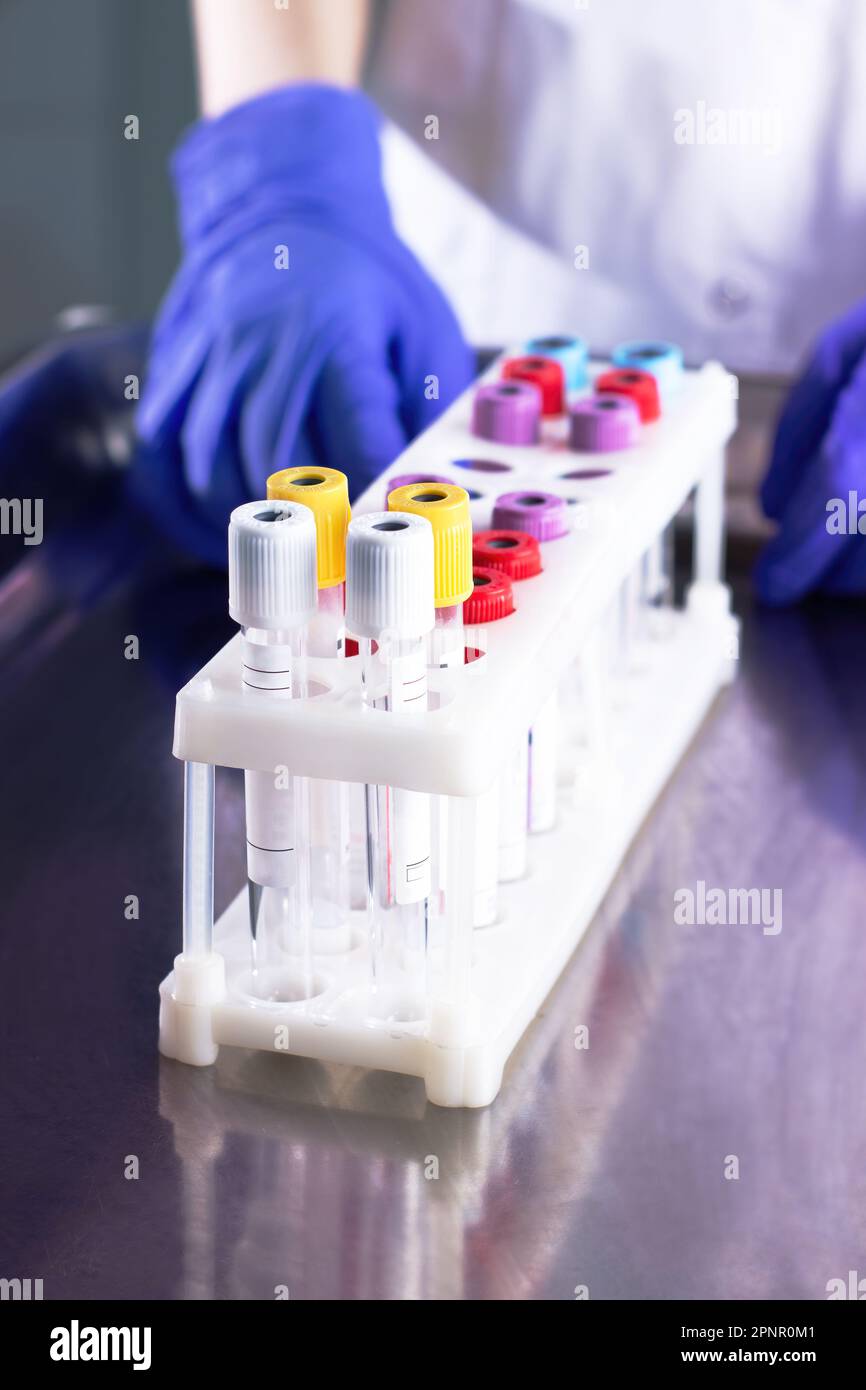 hands of a laboratory assistant with a blood sample and fortitude with ...